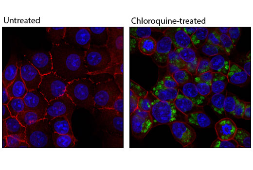 LC3A/B Antibody | Cell Signaling Technology