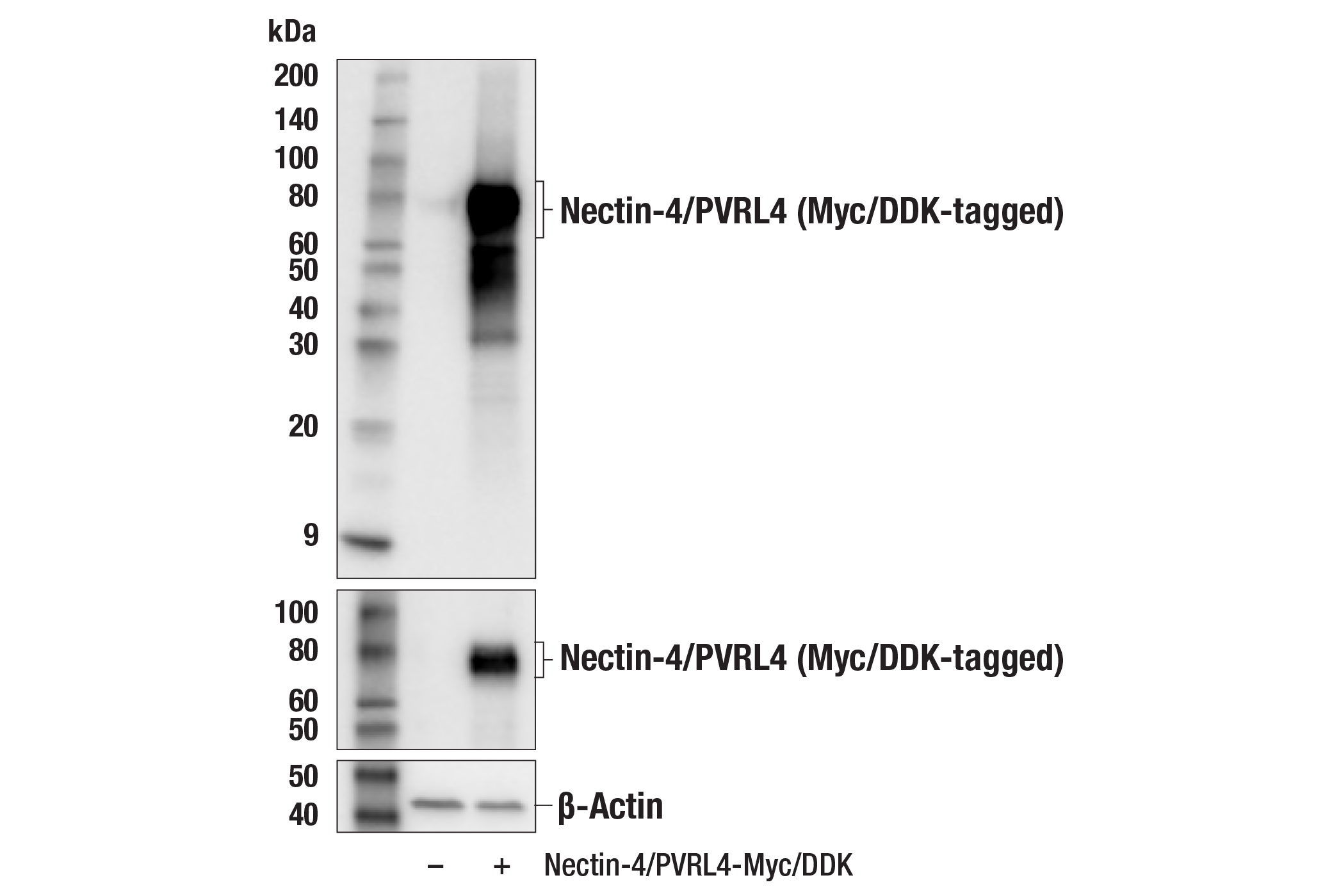 Nectin-4/PVRL4 (E5Q1W) Rabbit mAb | Cell Signaling Technology