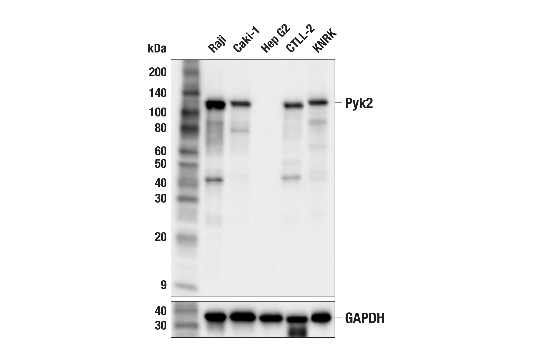 Pyk2 (F3I2K) Rabbit mAb | Cell Signaling Technology