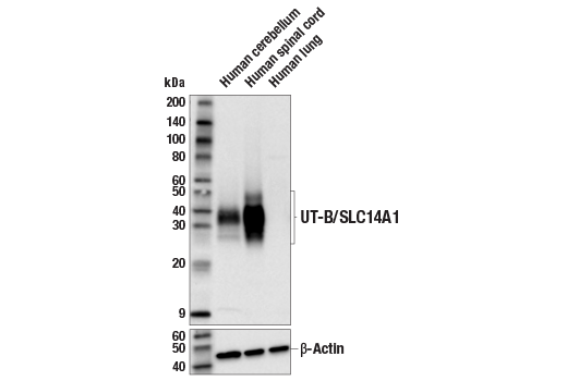 UT-B/SLC14A1 (E3S8J) Rabbit mAb | Cell Signaling Technology