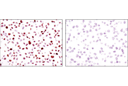HMGA2 (D1A7) Rabbit mAb (BSA and Azide Free) | Cell Signaling Technology