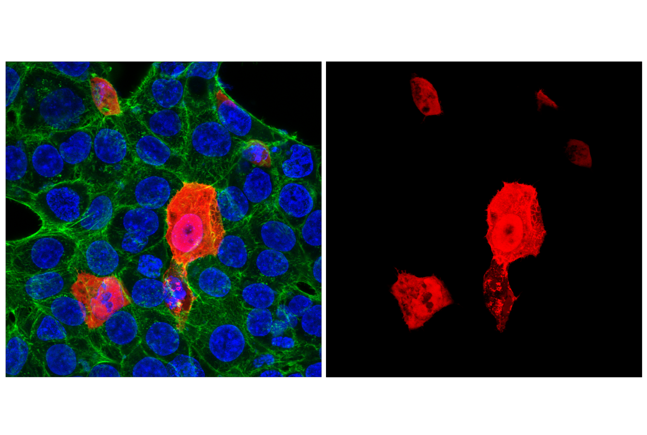 HA-Tag (C29F4) Rabbit mAb | Cell Signaling Technology