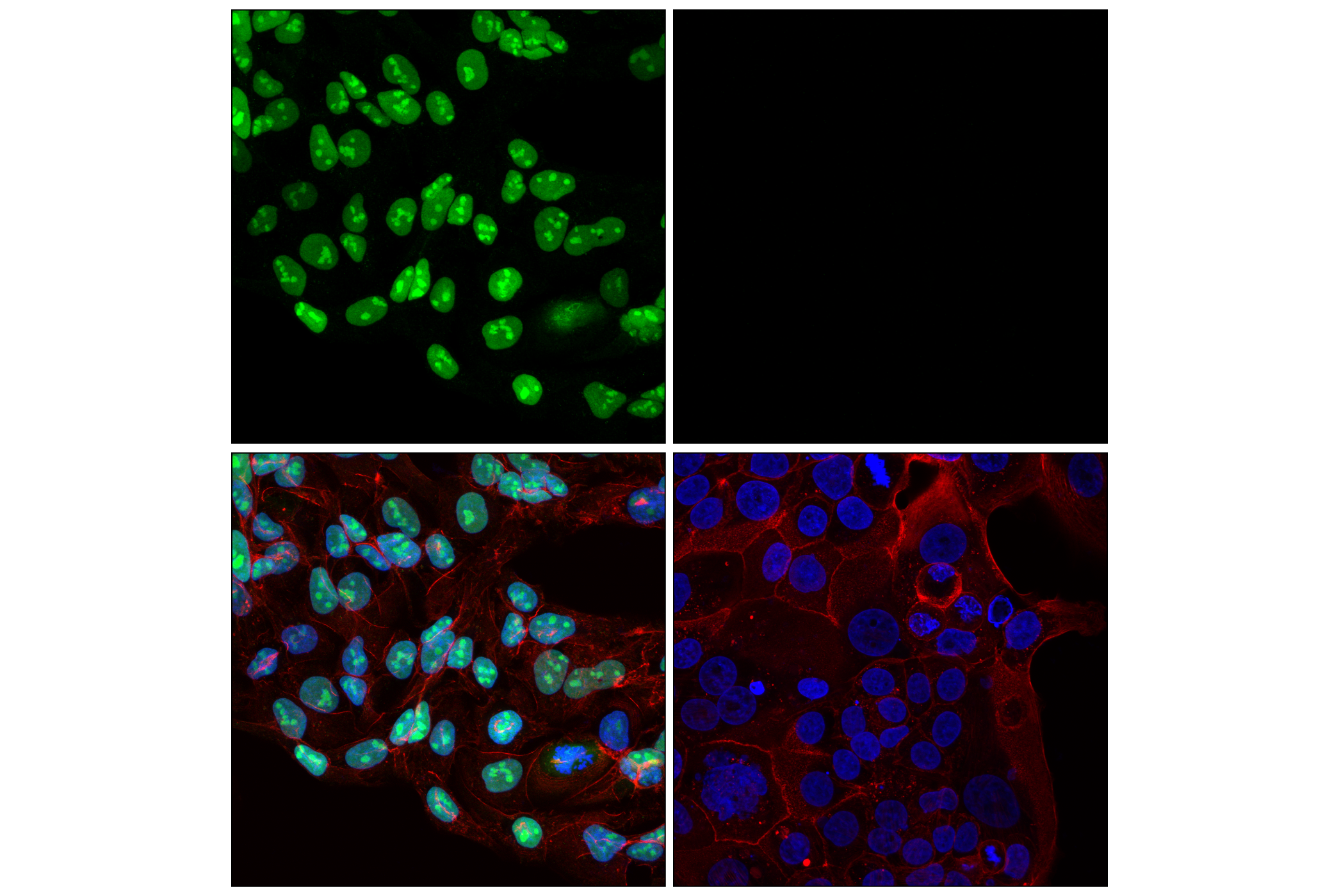 Basic FGF (E5Y6M) Rabbit mAb | Cell Signaling Technology