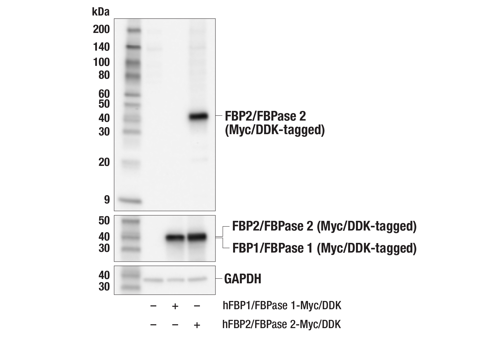 FBP2/FBPase 2 (E9M5T) Rabbit mAb | Cell Signaling Technology