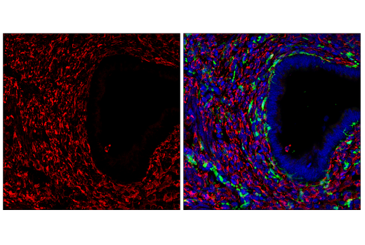 HSP47/SERPINH1 (E4L3I) Rabbit mAb | Cell Signaling Technology