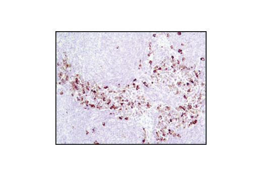 Phospho-S6 Ribosomal Protein (Ser235/236) (D57.2.2E) XP® Rabbit mAb | Cell Signaling Technology