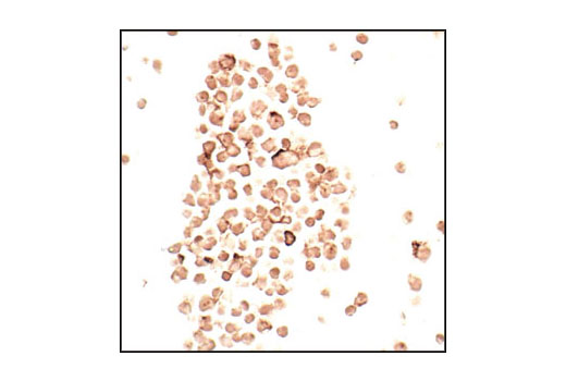 CD54/ICAM-1 Antibody | Cell Signaling Technology