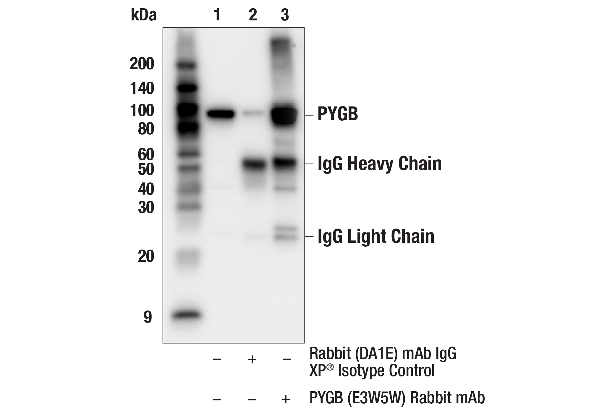 PYGB (E3W5W) Rabbit mAb | Cell Signaling Technology