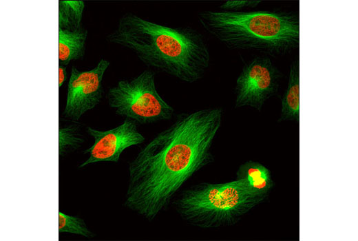 α-Tubulin (11H10) Rabbit mAb (Alexa Fluor® 488 Conjugate) | Cell ...
