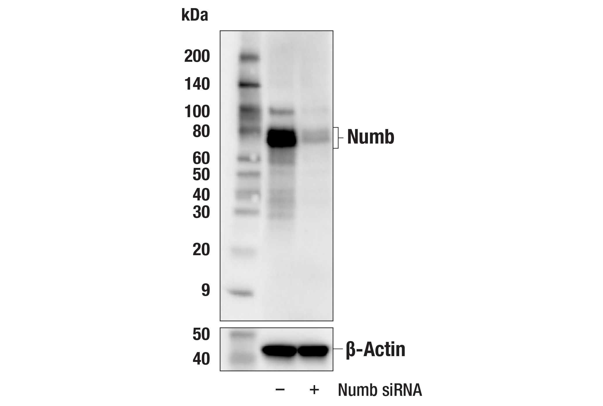 Numb (F4G6B) Mouse mAb | Cell Signaling Technology