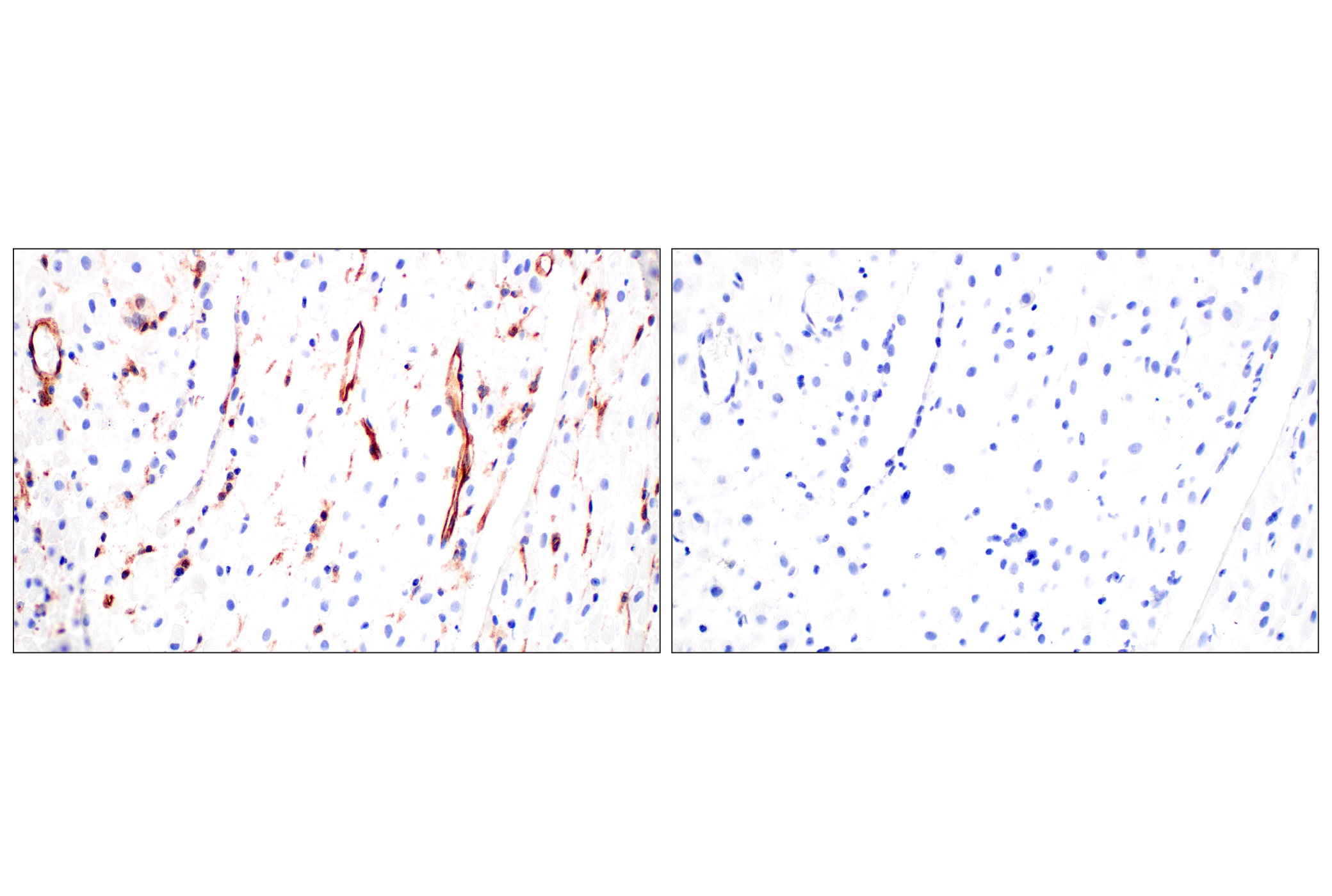 CD93/C1qR (E5H9B) Rabbit mAb (BSA and Azide Free) | Cell Signaling ...