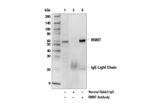 RNMT Antibody | Cell Signaling Technology