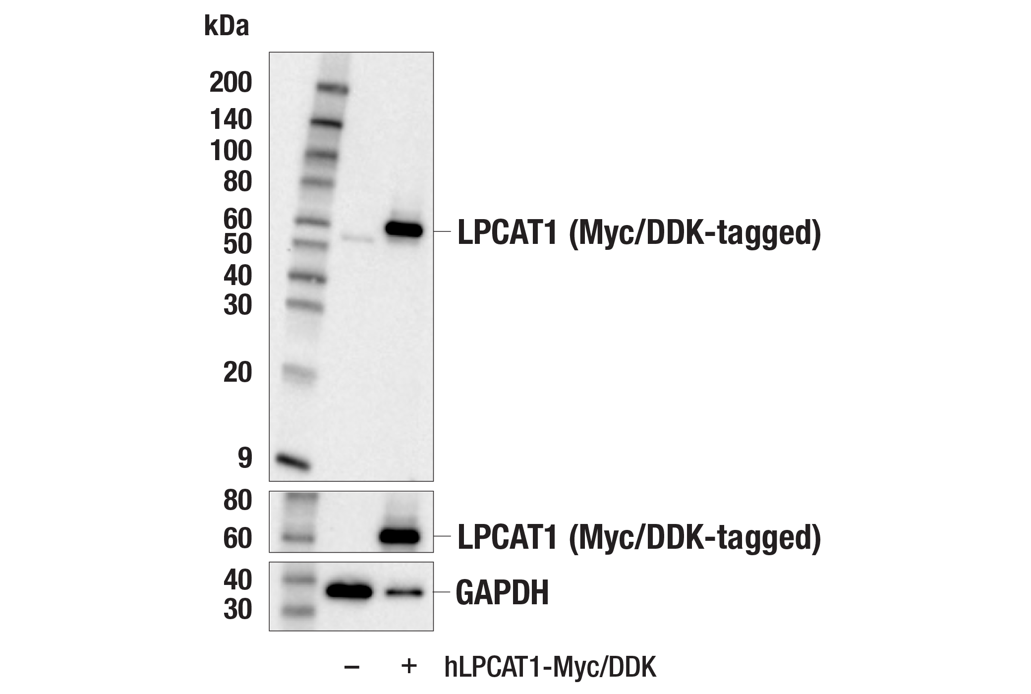 LPCAT1 (E4V4B) Rabbit mAb | Cell Signaling Technology