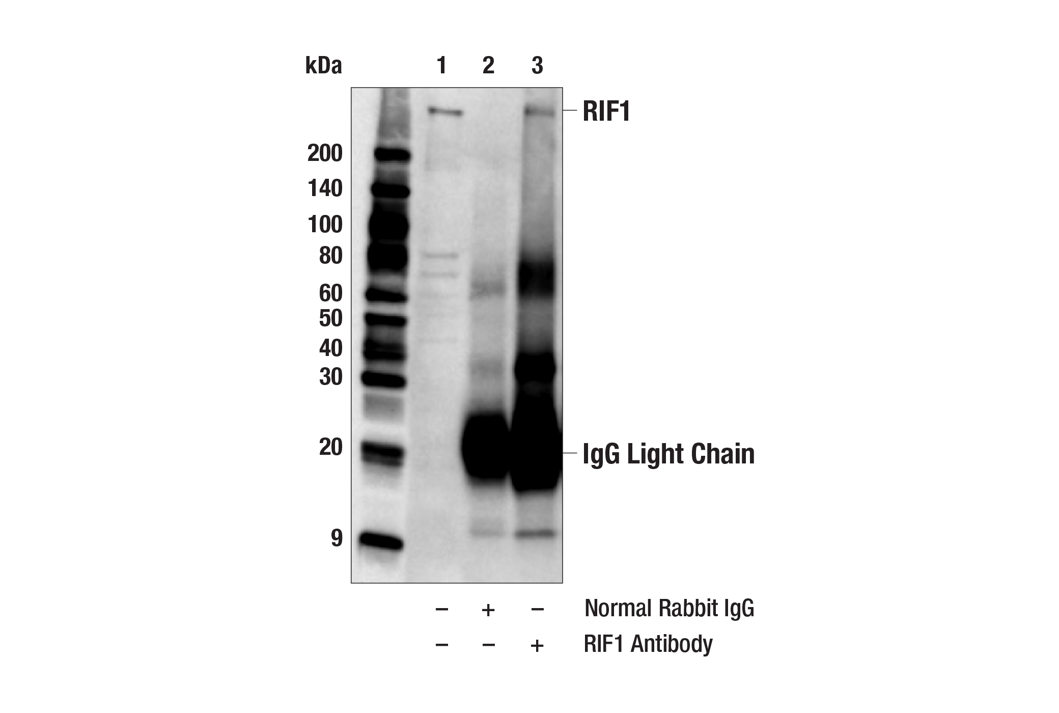 RIF1 Antibody | Cell Signaling Technology