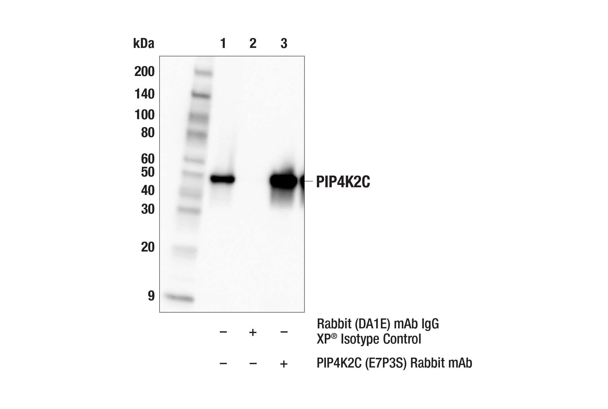 PIP4K2C (E7P3S) Rabbit mAb | Cell Signaling Technology