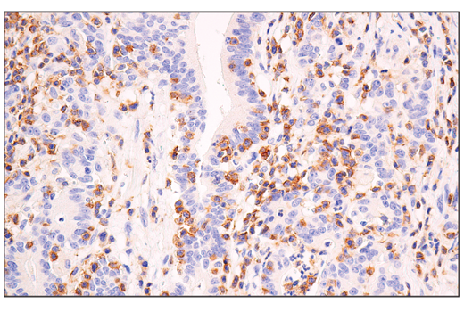 Semaphorin-4D/CD100 (E5C3B) XP® Rabbit mAb (BSA and Azide Free) | Cell ...