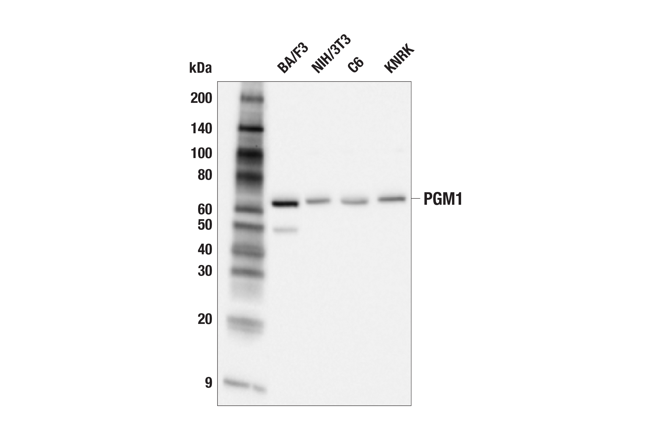 PGM1 (E2I5G) Rabbit mAb | Cell Signaling Technology