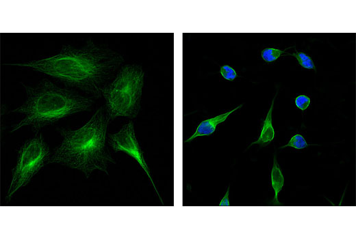 Cleaved PARP (Asp214) (D64E10) XP® Rabbit mAb (Alexa Fluor® 647 Conjugate) | Cell Signaling ...