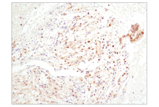NF-κB p65 (D14E12) XP® Rabbit mAb (BSA and Azide Free) | Cell Signaling ...
