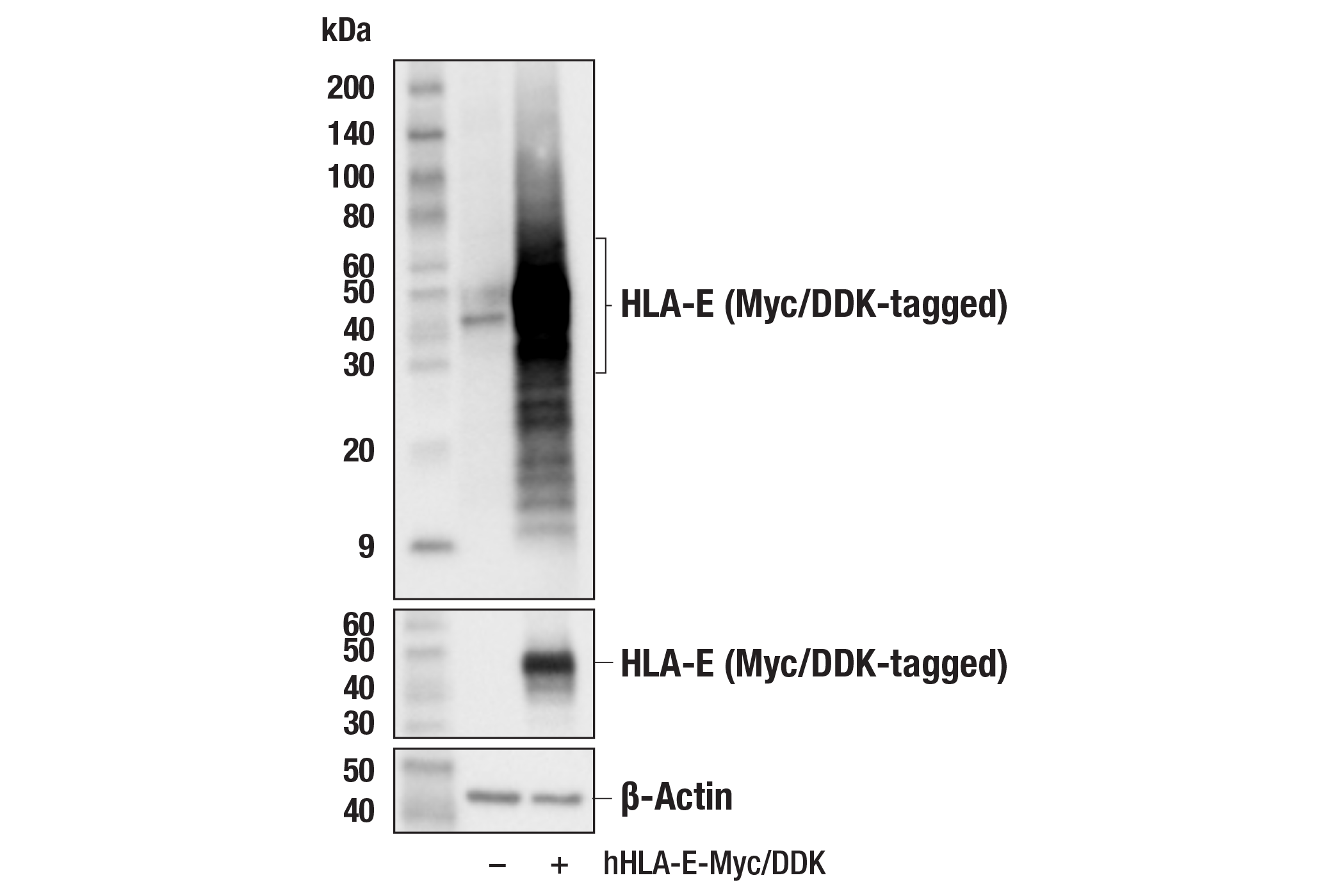 HLA-E (MEM-E/02) Mouse mAb | Cell Signaling Technology