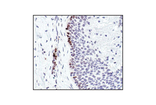 Phospho-Stat3 (Tyr705) (D3A7) XP® Rabbit mAb (BSA and Azide Free) | Cell Signaling Technology