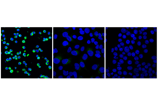 FGL1 (E7C1Q) XP® Rabbit mAb | Cell Signaling Technology