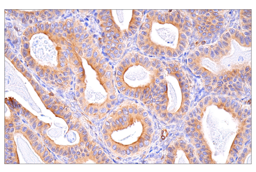 Tapasin (E6P1H) Rabbit mAb | Cell Signaling Technology