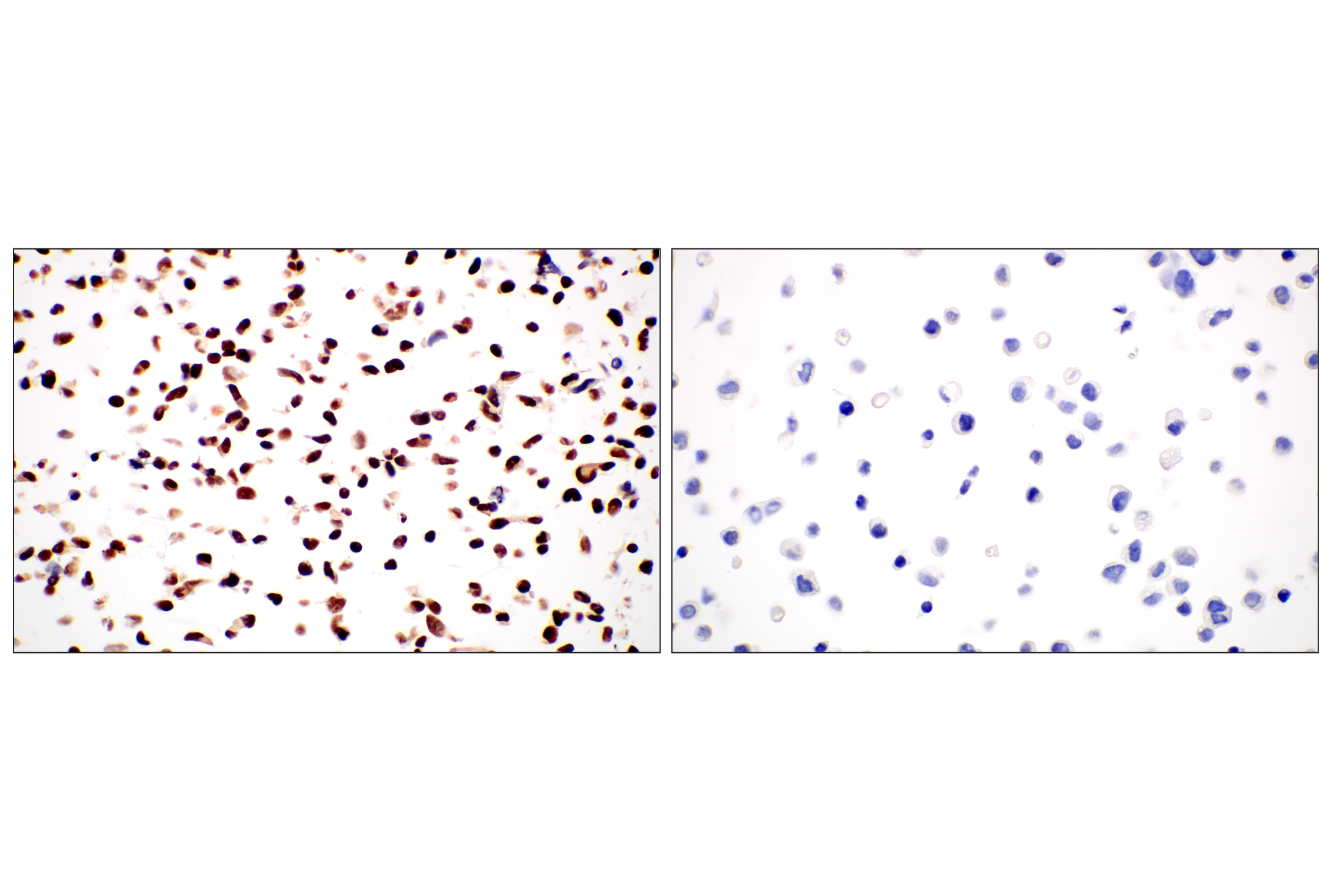 TCF12/HEB (E5R8X) Rabbit mAb | Cell Signaling Technology