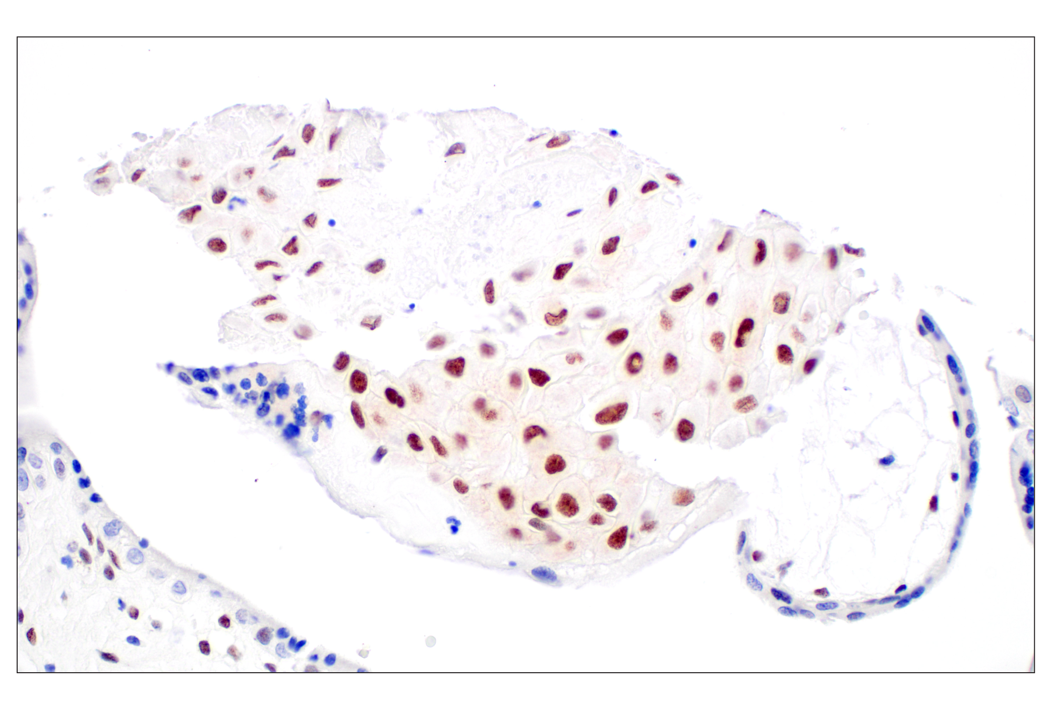 TCF12/HEB (E5R8X) Rabbit mAb | Cell Signaling Technology