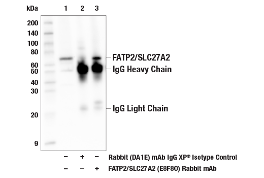 FATP2/SLC27A2 (E8F8O) Rabbit mAb | Cell Signaling Technology