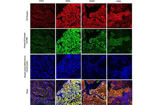 PathScan® EGF Receptor Activation Multiplex IF Kit | Cell Signaling ...