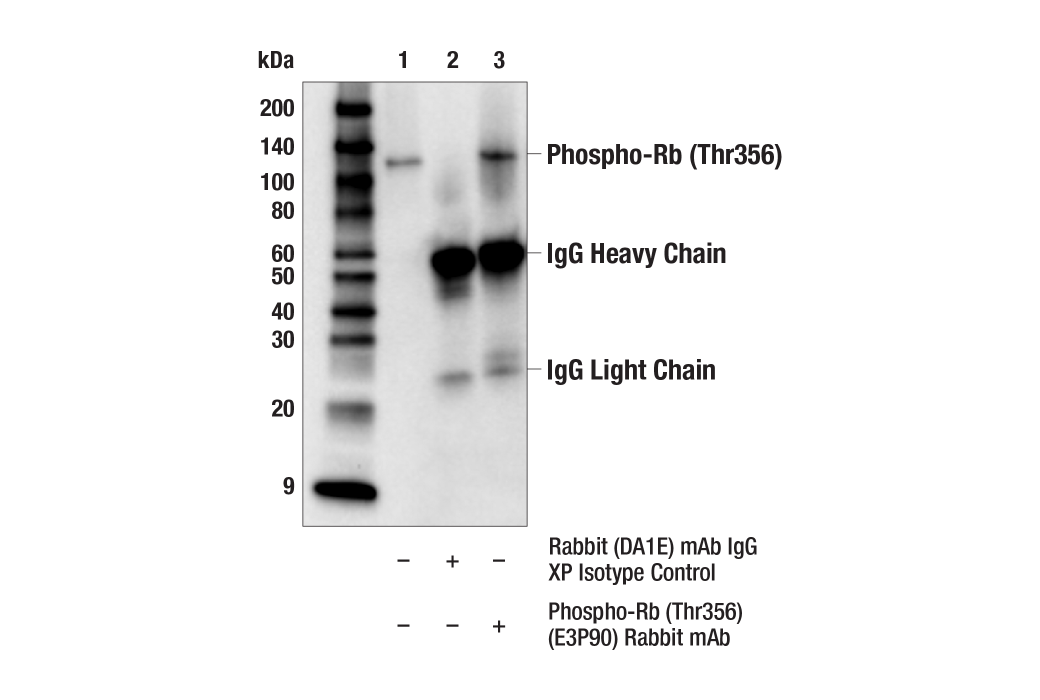 Phospho-Rb (Thr356) (E3P9O) Rabbit mAb | Cell Signaling Technology