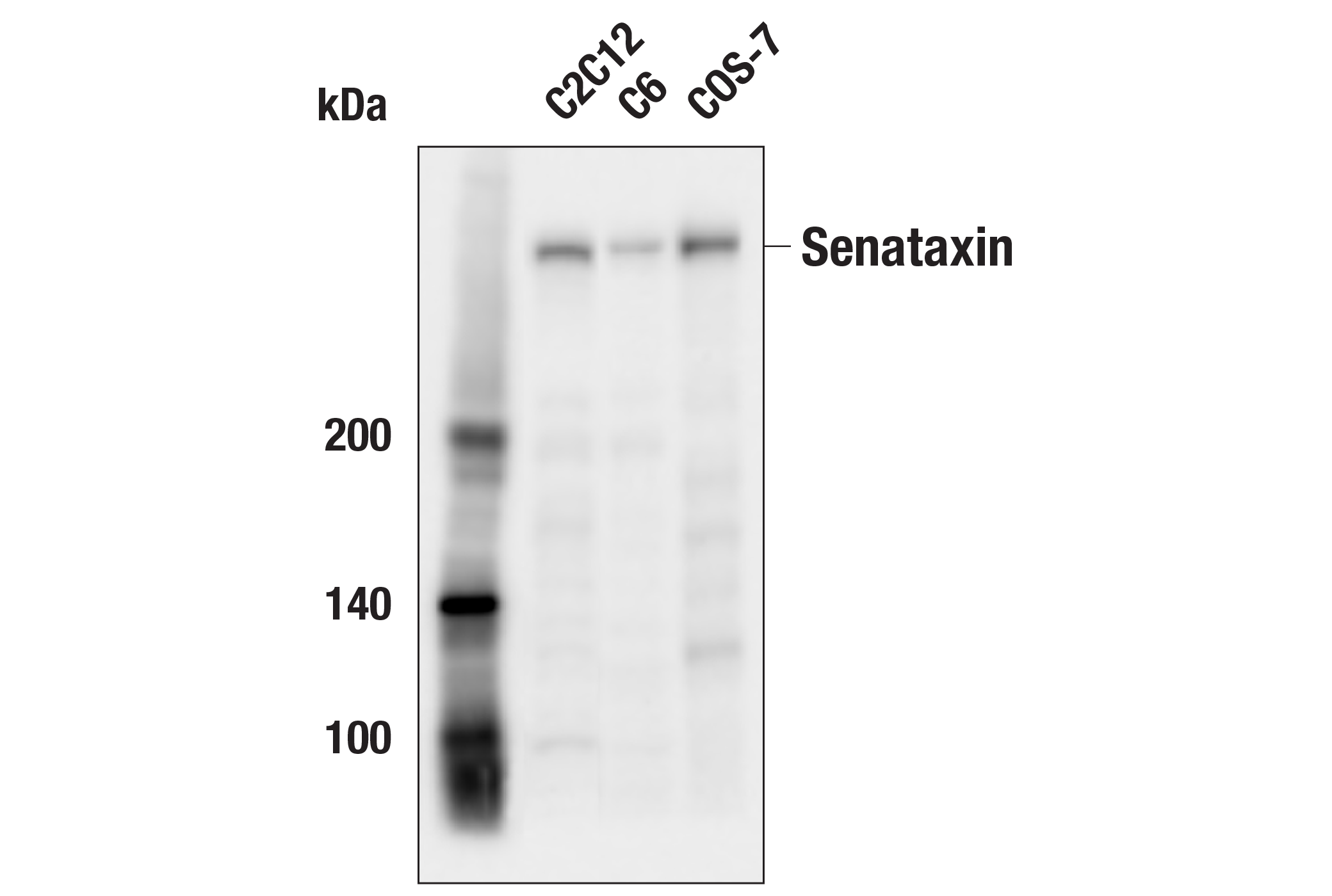 Senataxin (E9Z9F) Rabbit mAb | Cell Signaling Technology