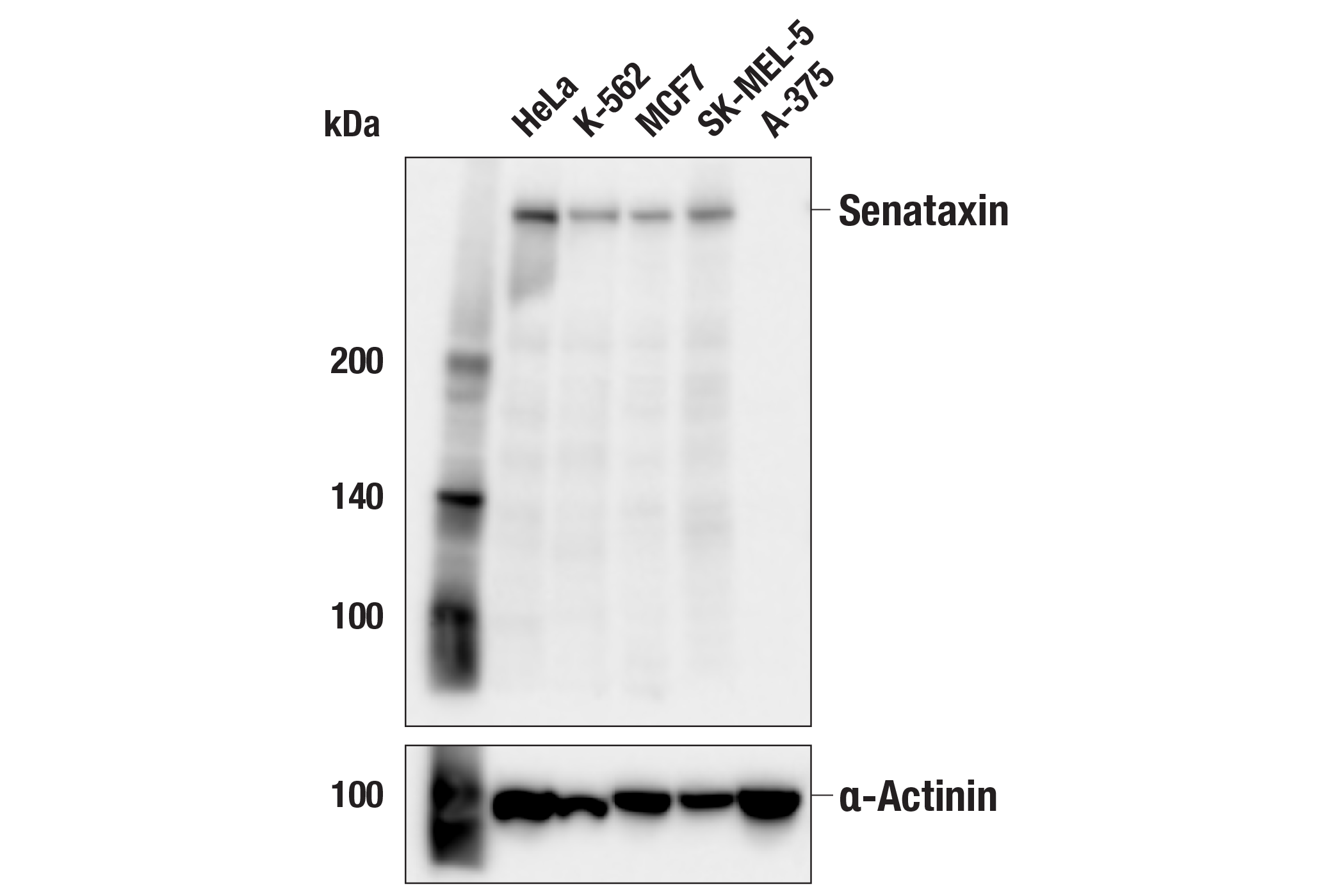 Senataxin (E9Z9F) Rabbit mAb | Cell Signaling Technology