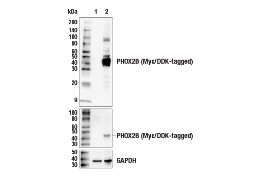PHOX2B Antibody | Cell Signaling Technology