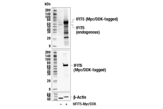 IFIT5 (E4O1Q) Rabbit mAb | Cell Signaling Technology