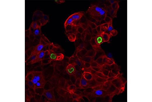 p21 Waf1/Cip1 (12D1) Rabbit mAb (Alexa Fluor® 647 Conjugate) | Cell ...