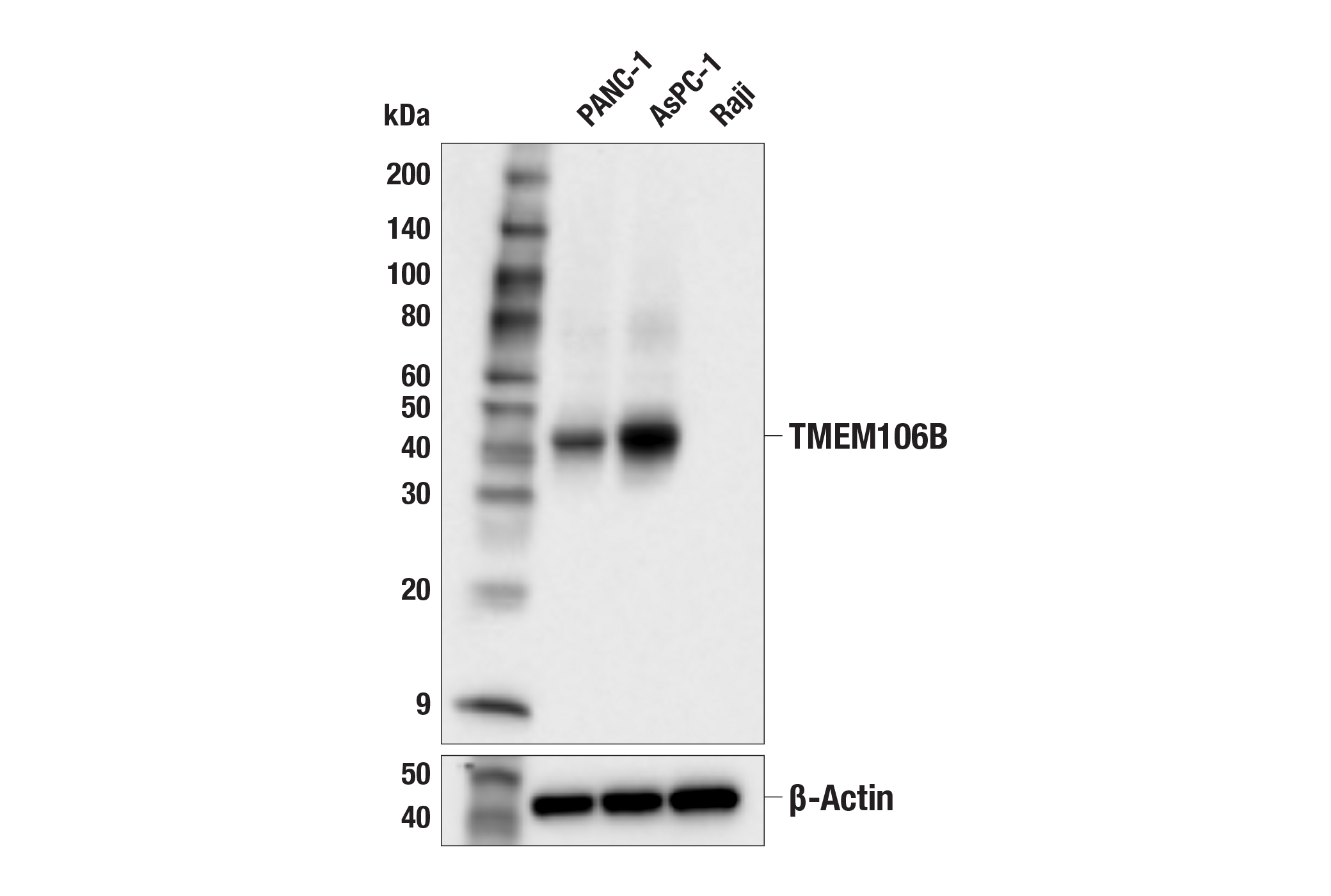 TMEM106B (F4D8C) Rabbit mAb | Cell Signaling Technology