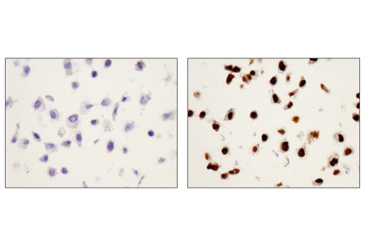 Phospho-Stat1 (Tyr701) (58D6) Rabbit mAb (BSA and Azide Free) | Cell ...