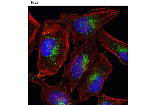 LAMP1 (D2D11) XP® Rabbit mAb | Cell Signaling Technology