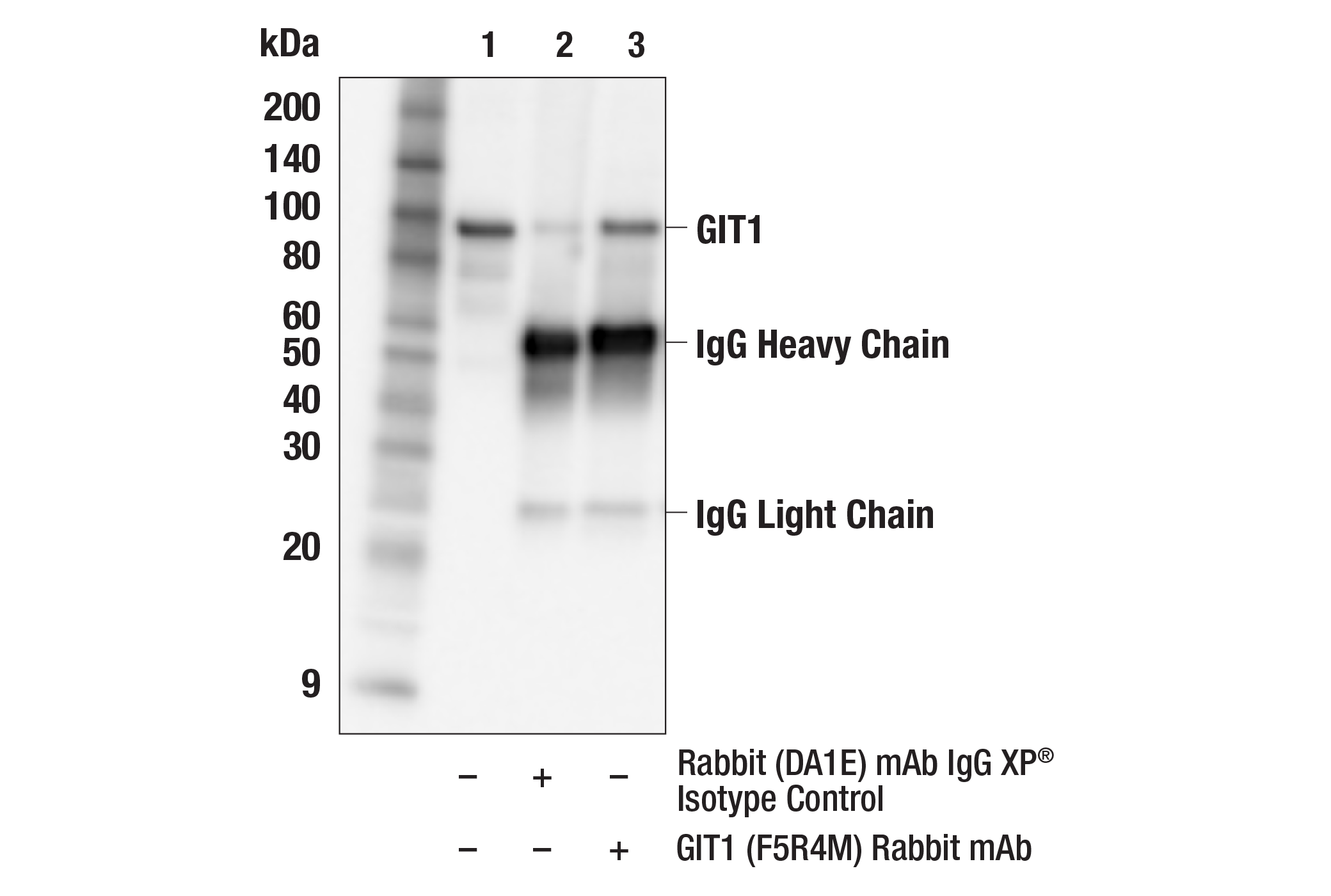 GIT1 (F5R4M) Rabbit mAb | Cell Signaling Technology