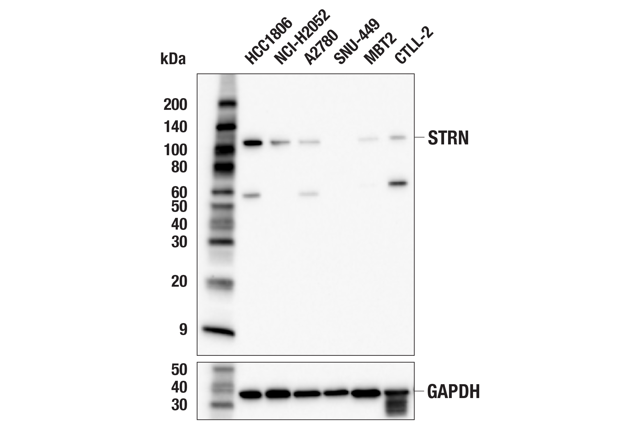 STRN (E9V5M) Rabbit mAb | Cell Signaling Technology