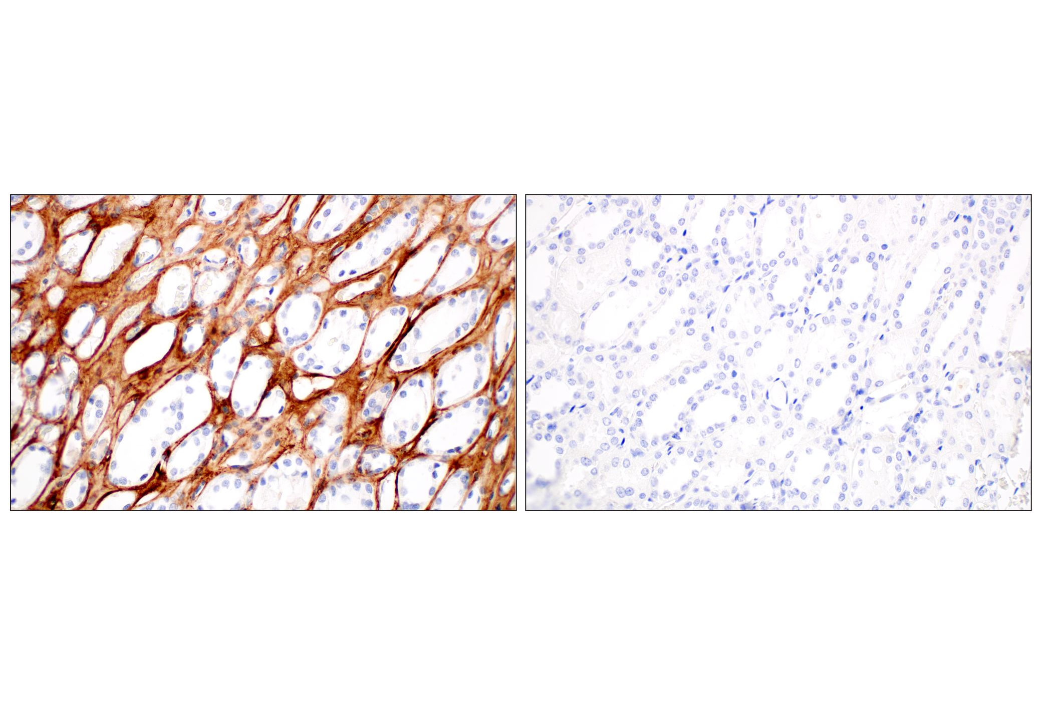 Tenascin C (E6N4L) Rabbit mAb | Cell Signaling Technology
