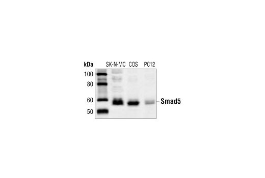 Smad5 Antibody | Cell Signaling Technology