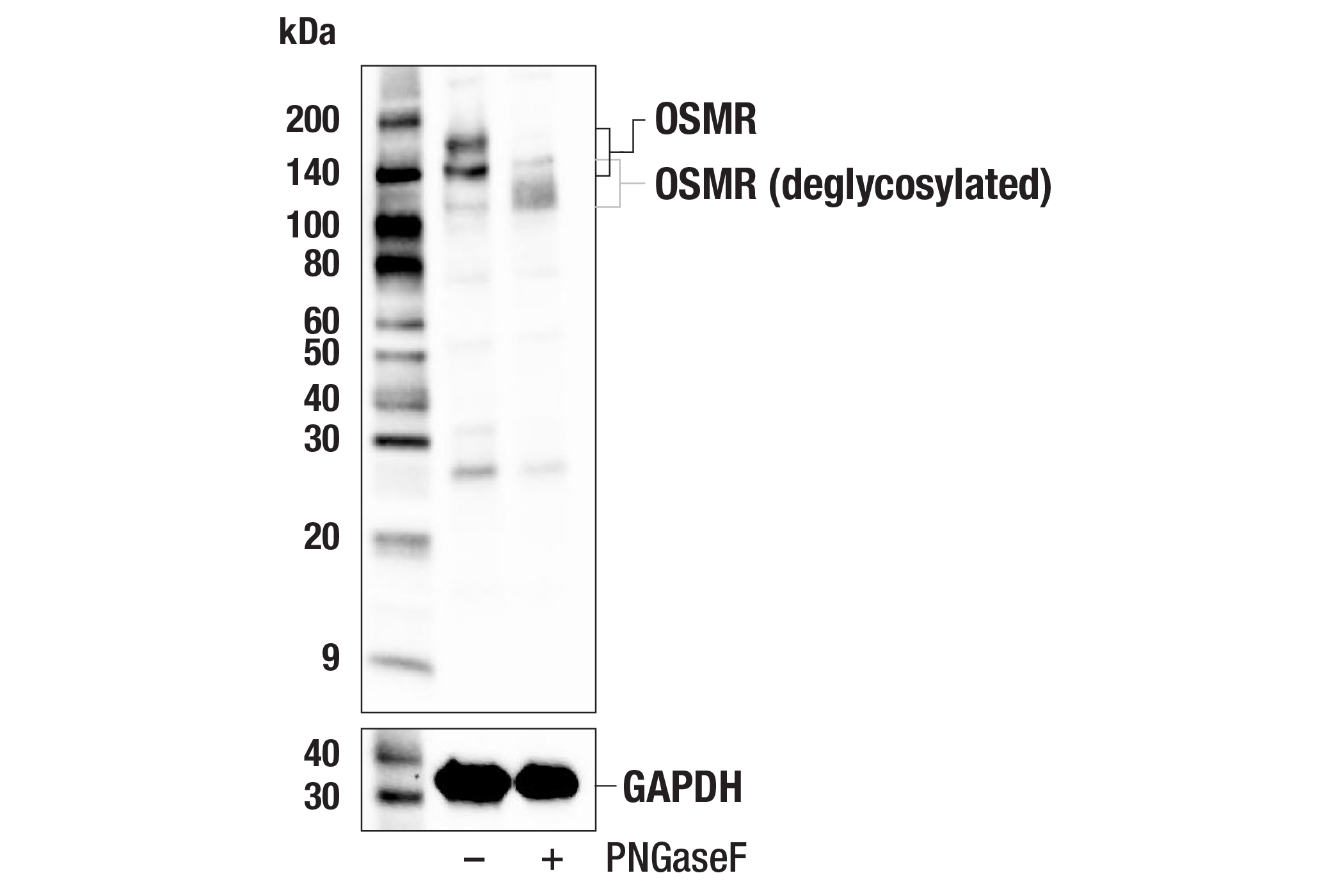 OSMR (F9Q2W) Rabbit mAb | Cell Signaling Technology