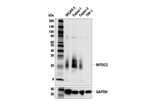 WFDC2 (E8S8Z) Rabbit mAb | Cell Signaling Technology