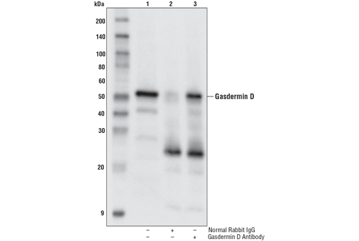 Gasdermin D Antibody | Cell Signaling Technology