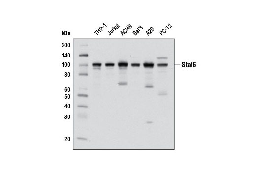 Stat6 Antibody | Cell Signaling Technology