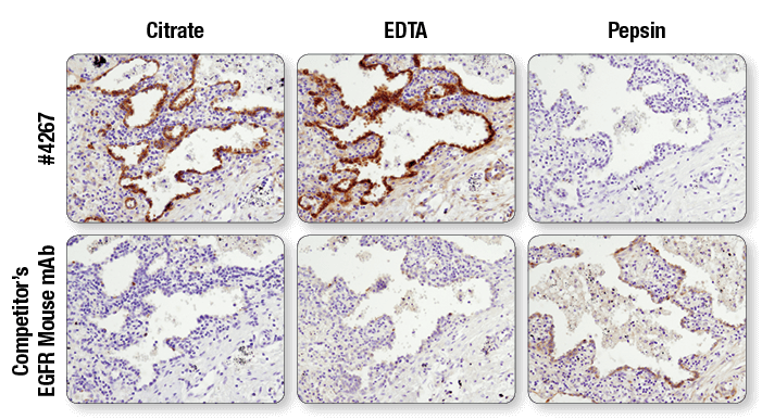 通过免疫组织化学法 (IHC) 了解组织中的蛋白表达 | Cell Signaling Technology