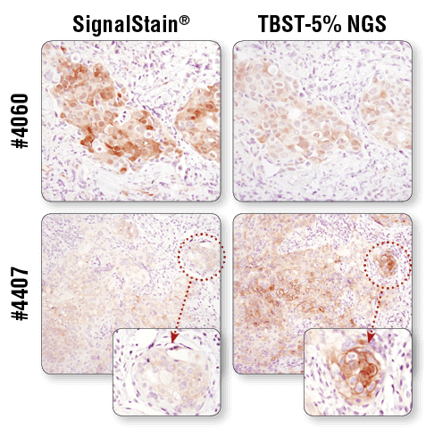 免疫组织化学法 (IHC) 疑难排除和使用对照 | Cell Signaling Technology
